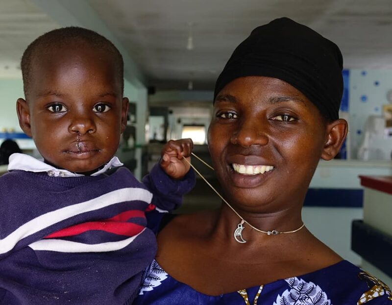 What is Cleft? - Transforming Cleft