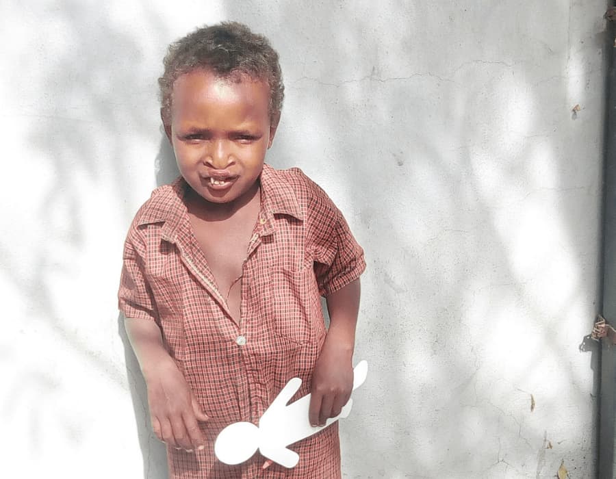 Ethiopia: Meet Kalid - Transforming Cleft