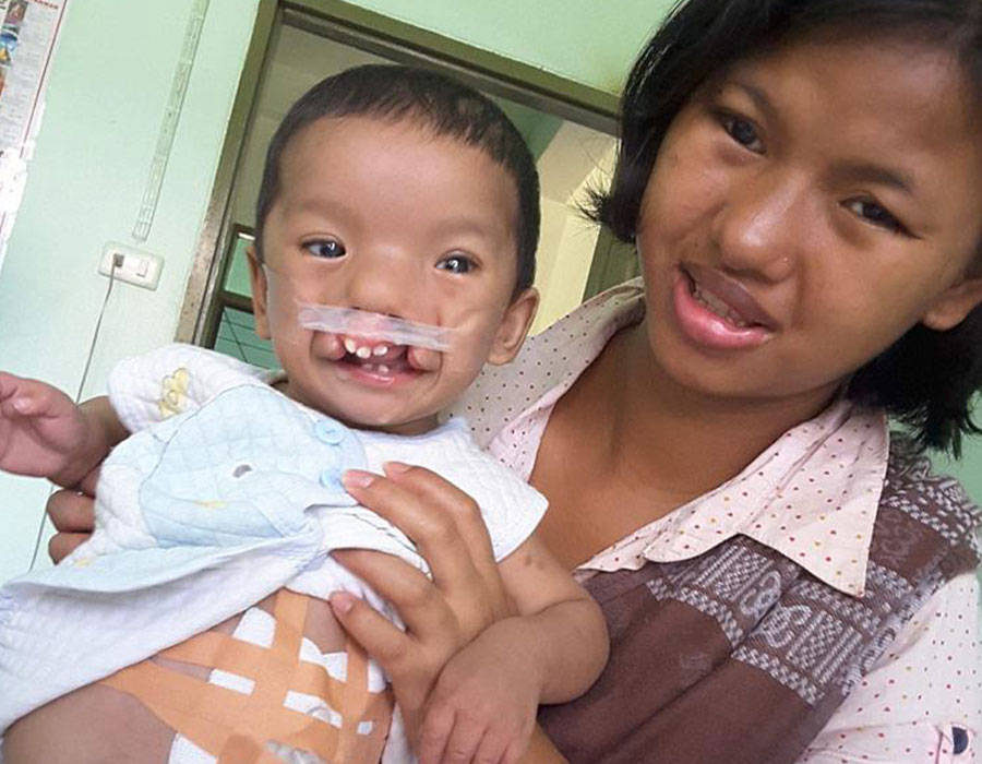 Comprehensive Cleft Care for Newborns in Myanmar - Transforming Cleft