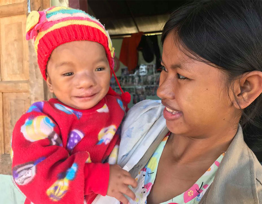 Comprehensive Cleft Care for Newborns in Myanmar - Transforming Cleft