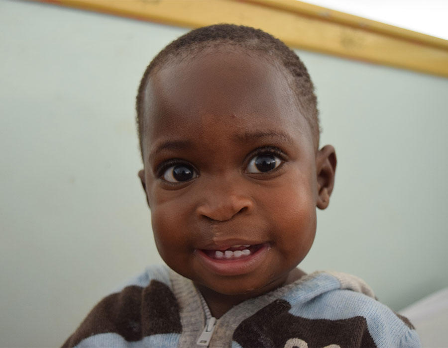 Uganda: Meet Prossy - Transforming Cleft